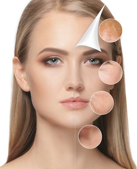 IPL/LimeLight - New Creation MediCosmetic MediCosmetic Centre